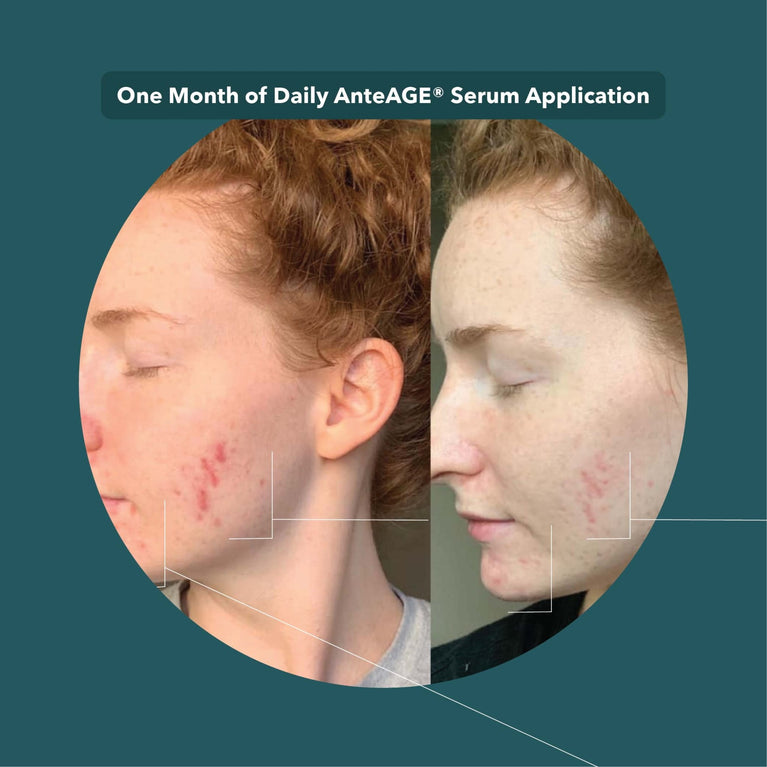 AnteAGE MD System | Shop HARBEN HOUSE – Harben House