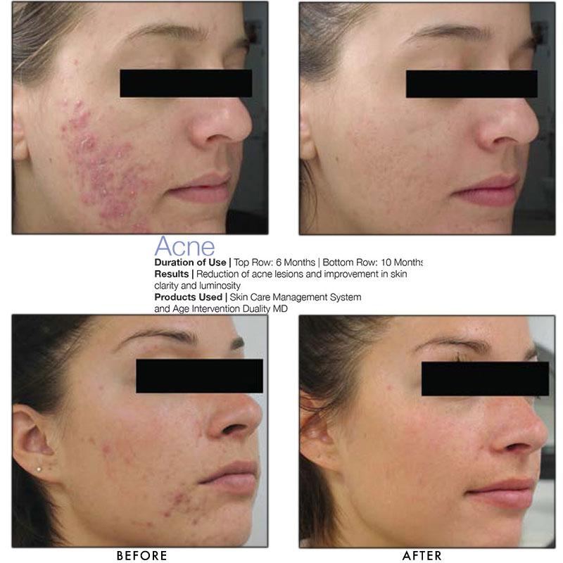 Jan Marini Age Intervention Duality MD | Shop HARBEN HOUSE – Harben House