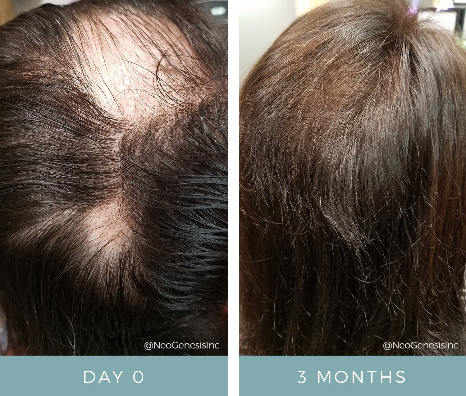 NeoGenesis Hair Serum 30ml