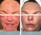 NeoGenesis Recovery | Shop Harben House